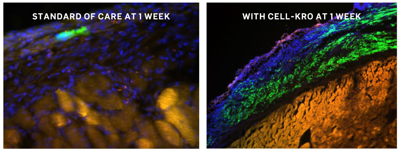 Cell-Kro | Biologic Grafting Drug | Samba BioLogics, Inc